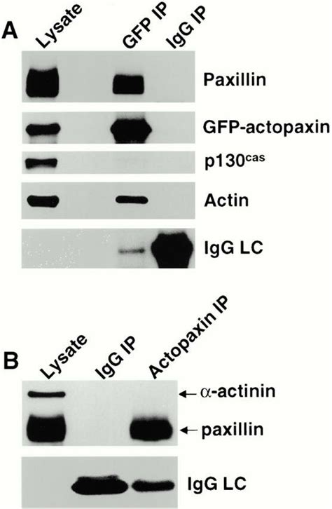 Actopaxin Binds To Paxillin And Actin In Vivo A Gfp Actopaxin Was