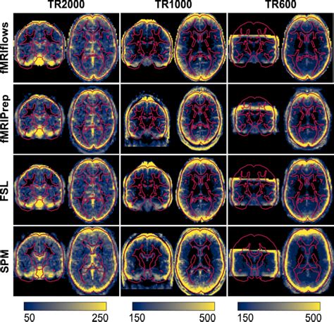 Depiction Of Standard Deviation Maps Of The Temporal Averages Of Three Download Scientific