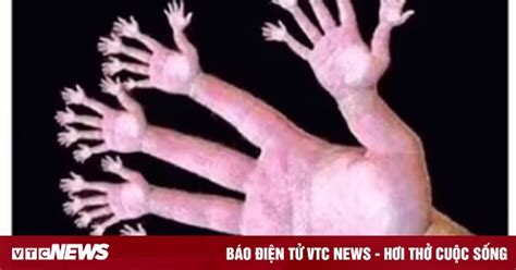 Có bao nhiêu ngón tay trong hình này