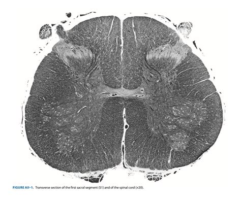 Myelin Stained Sections The Neurosurgical Atlas
