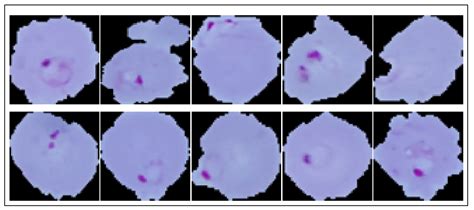 Performance Analysis Of Deep Learning Algorithms In Diagnosis Of