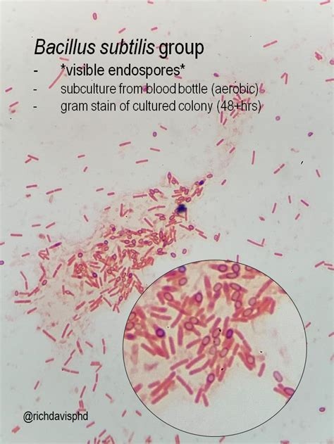 Bacillus Subtilis Spore Stain