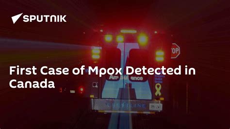 First Case Of Mpox Detected In Canada