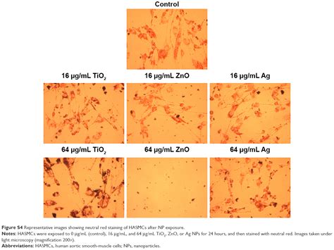 A Comparative Study Of Toxicity Of TiO2 ZnO And Ag Nanoparticles To IJN