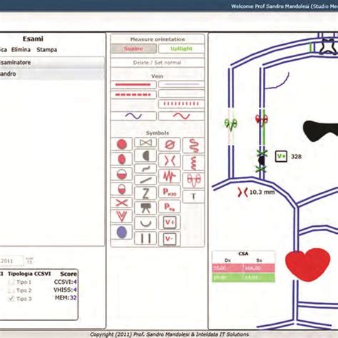 Morphological Hemodynamic Map Mem Scheme Representing Pattern Of