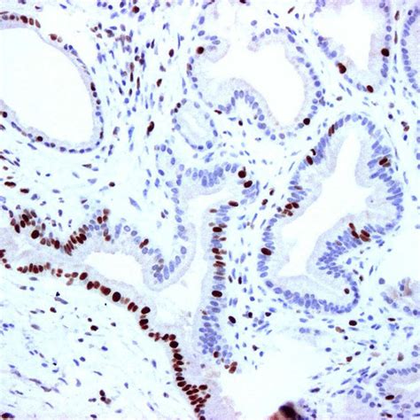 After The Reconstruction Hepaticojejunostomy Is Mirrored Download Scientific Diagram