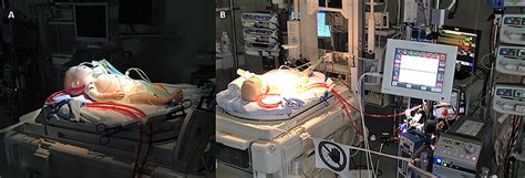 Frontiers Start A Neonatal Extracorporeal Membrane Oxygenation