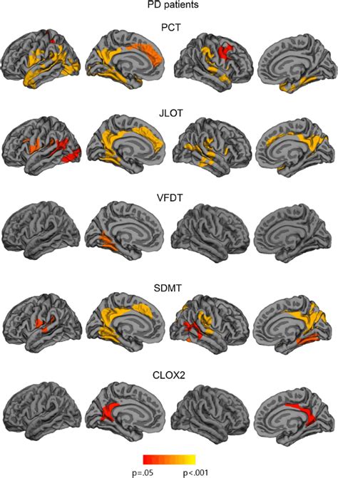 Vertex Wise Cortical Thickness Correlations With Neuropsychological