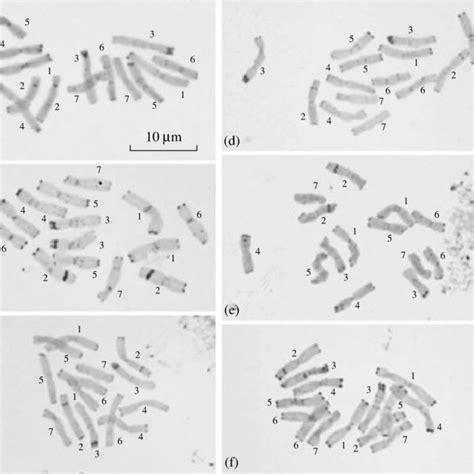 Distribution Of Heterochromatin Blocks On Metaphase Chromosomes Of The