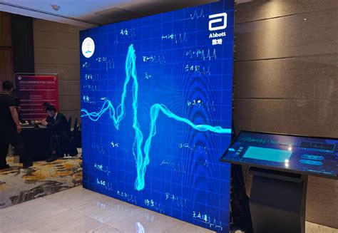 心电图数据的r波峰值检测matlab仿真理论基础 生物传感器 心电 脉搏