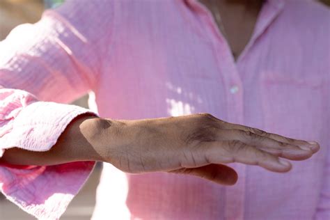 75 Of People With Autoimmune Disease Have This In Common New Study