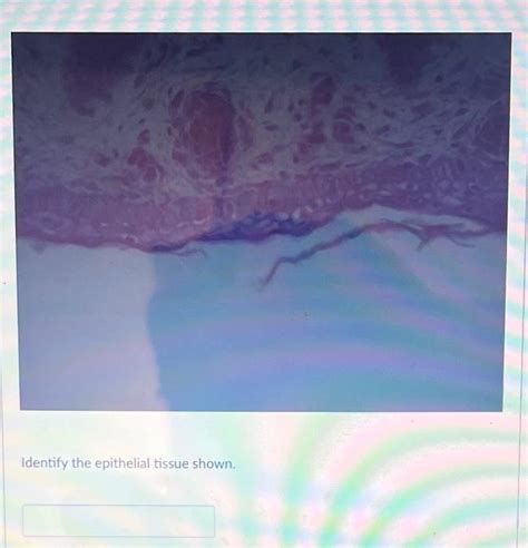 Solved Identify The Epithelial Tissue Shown Chegg