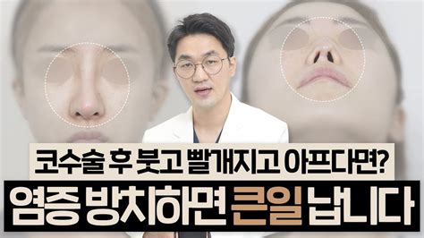 코수술 후 염증 증상 괜찮겠지 하고 방치했다간큰일 납니다｜염증의 원인 증상 해결방법은 Youtube