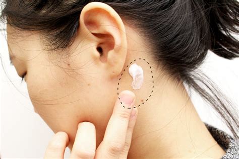 A Patch Test Is Generally Conducted Behind The Ear Or