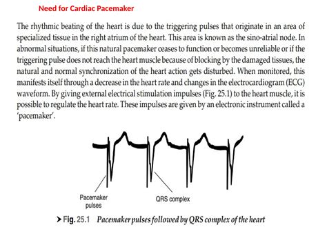 Unit 6 Pacemaker Ppt All Pace Maker Introduction In The Ppt Pptx