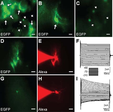 Figure 1 From Two Types Of Astrocytic Cell In The Adult Striatum Semantic Scholar