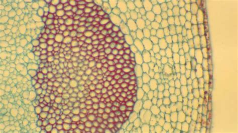 Sclerenchyma Under Microscope