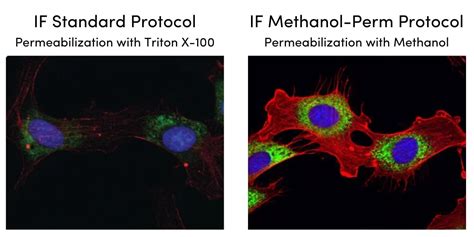 Successful Immunofluorescence Fixation And Permeabilization Cst Blog