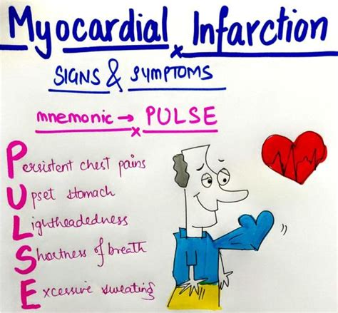 Myocardial Infarction Symptoms Pulse Mnemonic For Heart Attack