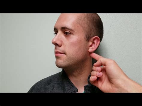 Chvostek S Signs And Symptoms Hypocalcemia Emergency Care Bc