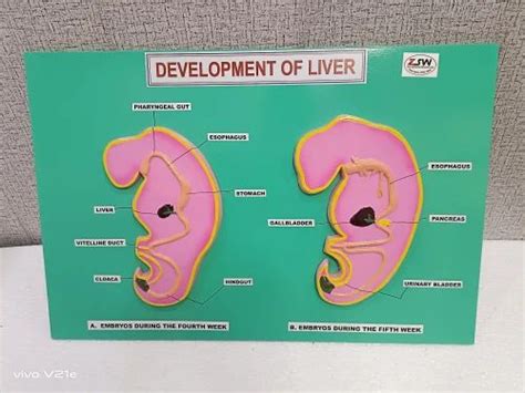 Development Of Liver Model At ₹ 2250 Piece Anatomical Models In Ambala Id 2856095239033