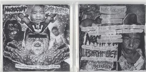 Necrocyst Birth Defects Pityriasis Rosea Like Smallpox Eruption