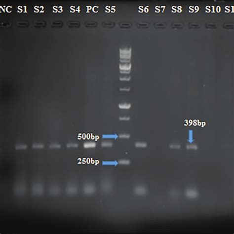 The Second Round Of Polymerase Chain Reaction For The Detection Of Download Scientific Diagram