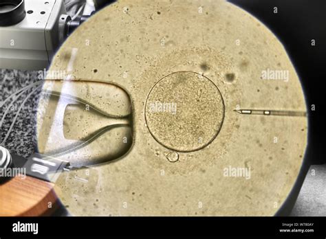 Amazing Process Of The In Vitro Fertilization Of A Female Egg Through