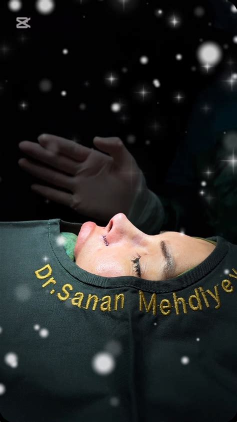 Mehdiyev Senan Dr Sanan Mehdiyev • Instagram Photos And Videos
