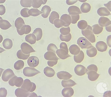 Developmental Stages Of Plasmodium Vivax 1