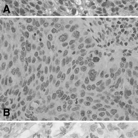 Representative Immunohistochemical Staining Of Prostate Stem Cell Download Scientific Diagram