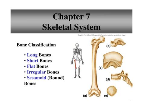 Sarcoma Bone Flat Bone