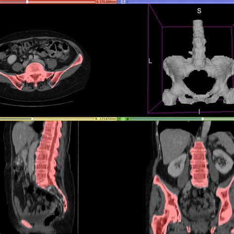 pdf ct org a new dataset for multiple organ segmentation in computed