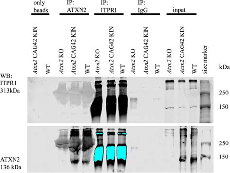 No Interaction Of Itpr1 With Normal And Expanded Atxn2 In Download