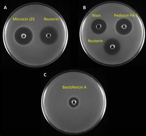 In Vitro Assessment Of Skin Sensitization Irritability And Toxicity Of Bacteriocins And