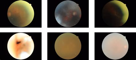 Examples Of Few Low Quality Images Download Scientific Diagram