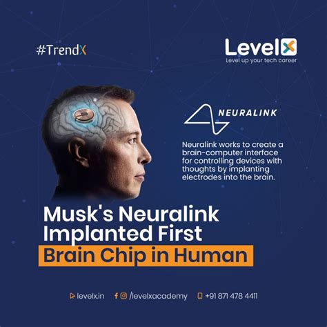 Levelx On Linkedin Elonmusk Tech Trendx Neuralink Technews It