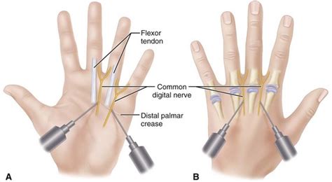 Basic Surgical Technique And Postoperative Care Musculoskeletal Key