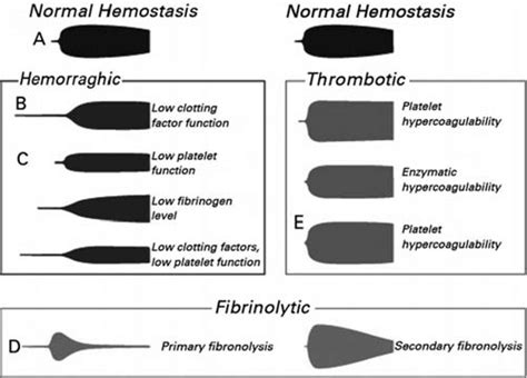 Teg Report On Clot Characteristics Download Scientific Diagram