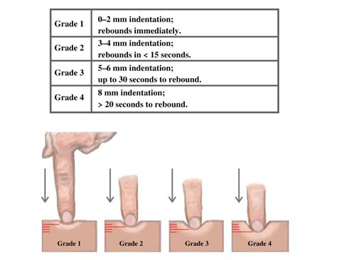 53 General Cardiovascular System Assessment Health Alterations