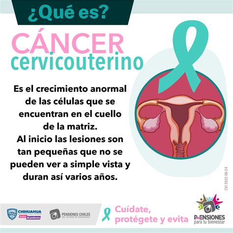 Avisos Pce