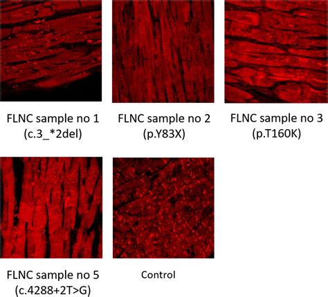 Rna Sequencing Based Transcriptome Profiling Of Cardiac Tissue