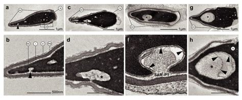 Transmission Electron Microscopy TEM Micrographs Of Longitudinal Download Scientific Diagram
