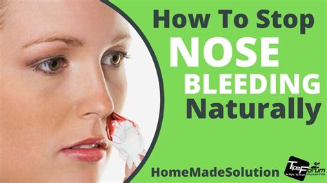 Is It Bad To Lean Back When Your Nose Is Bleeding At Hayden Marr Blog