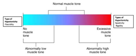 1007 Neuro Objective Neurological Assessment Flashcards Quizlet