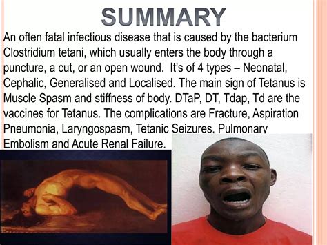Tetanus Also Called Lockjaw Pptx