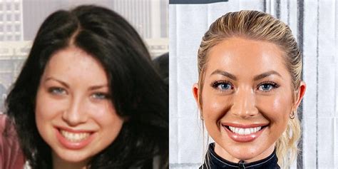 Vanderpump Rules Star Stassi Schroeder Says Her Chin Implant Makes Me Feel Better About