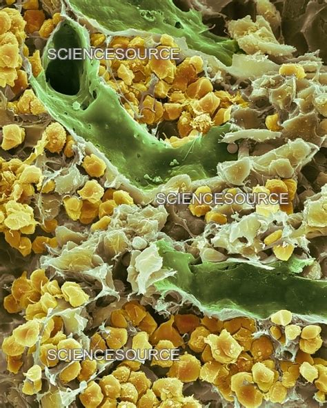 Bone Marrow Scanning Electron Microgr Stock Image Science Source