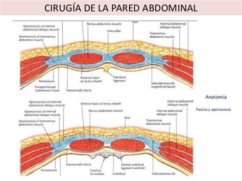 Pared Abdominal