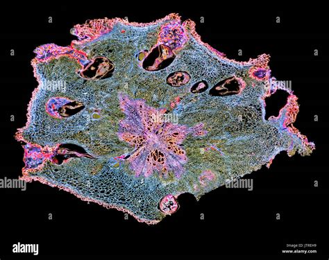 Tomato Root Eelworm Infestation Nodule Darkfield Photomicrograph Ts